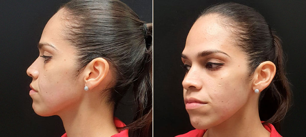 Liftherapy® - nuBODY